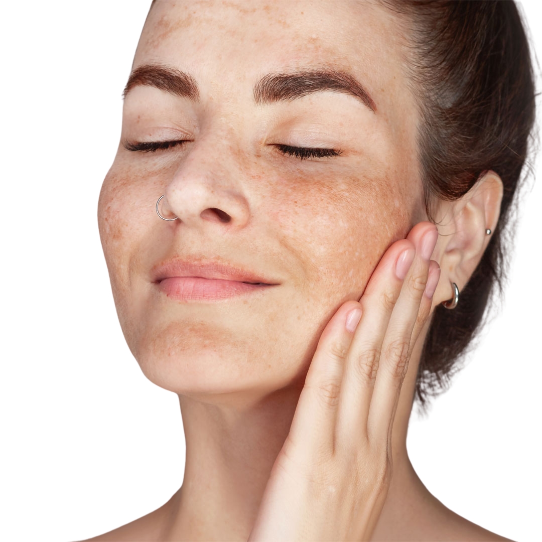 Sciton BBL HEROic Forever Young - Klinika Spire Clinic - Odmładzanie Genowe